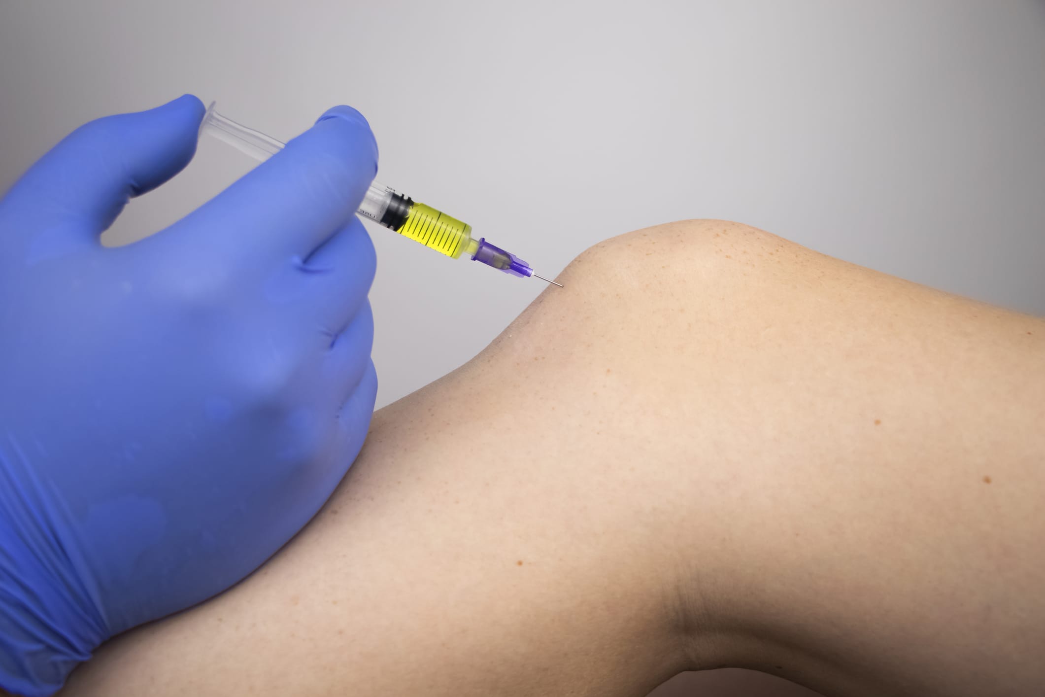 The Science Behind PRP Injections: How Growth Factors and Healing ...