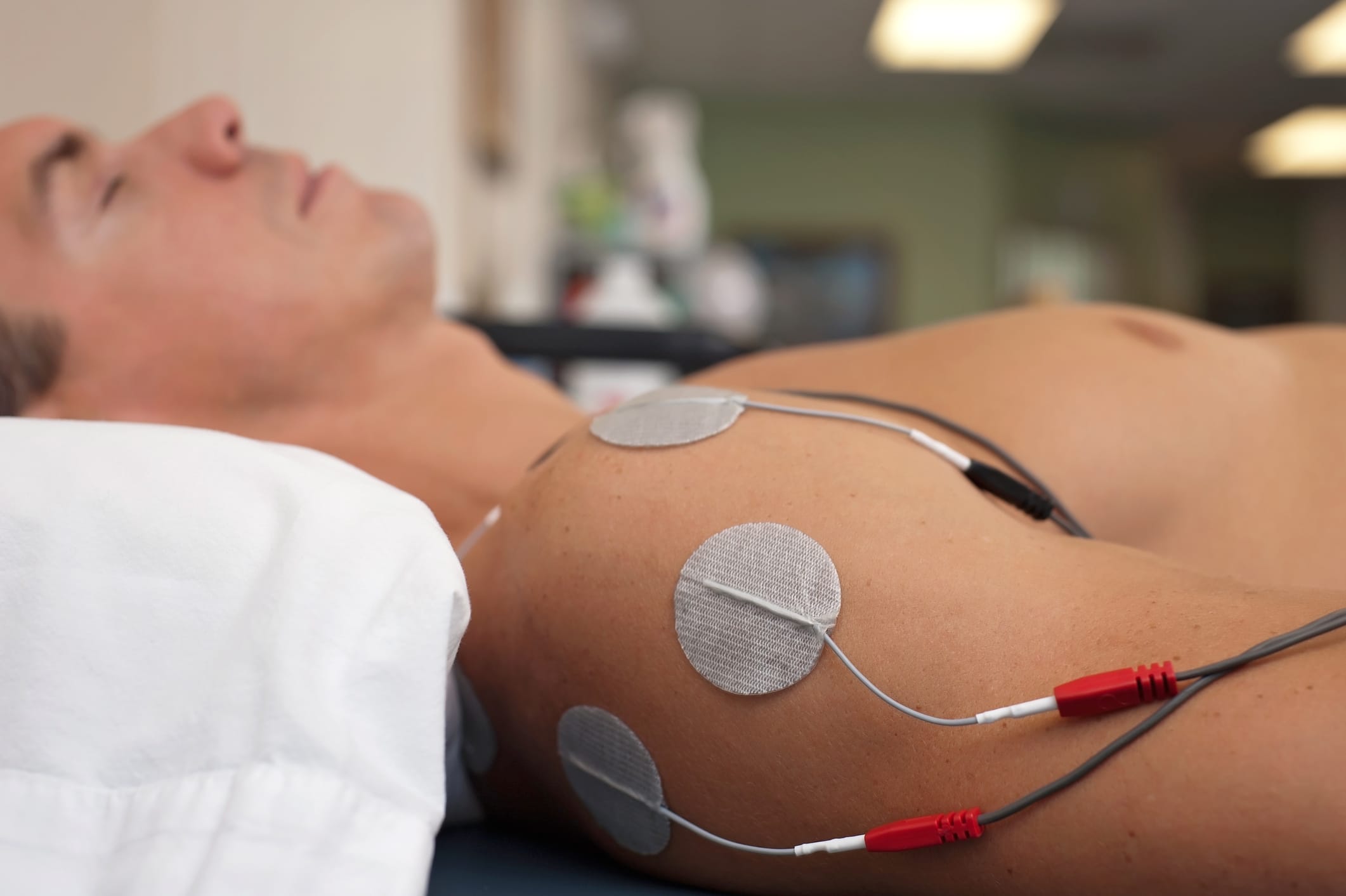The Rise of Electrical Stimulation in Neuropathic Pain - Pain ...